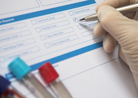 Nagalase Blood Test: Too Good To Be True? - SelfDecode Labs