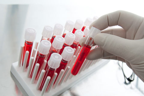 Lactate Dehydrogenase Test: Normal Range + High Levels - SelfDecode Labs