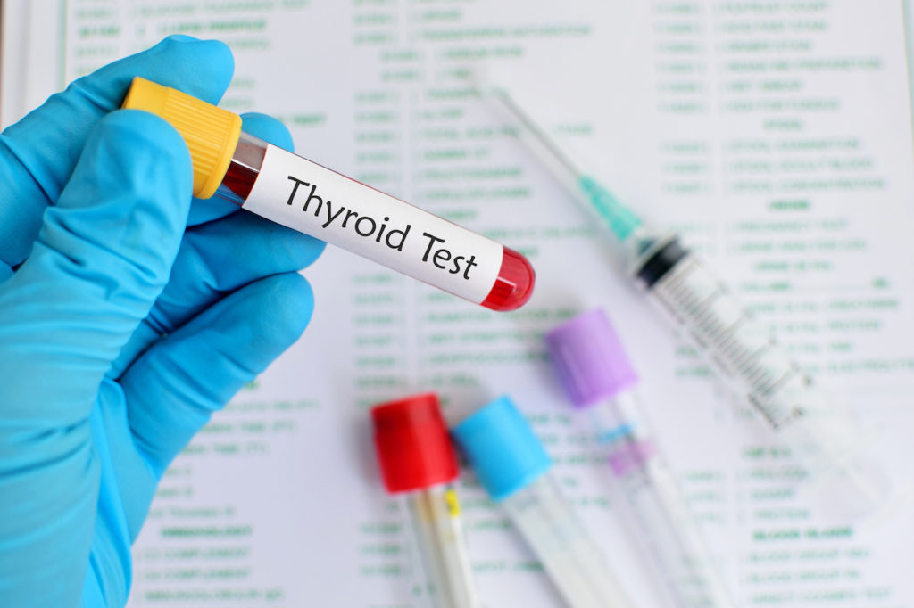 T3 Uptake Blood Test and Normal Levels - SelfDecode Labs